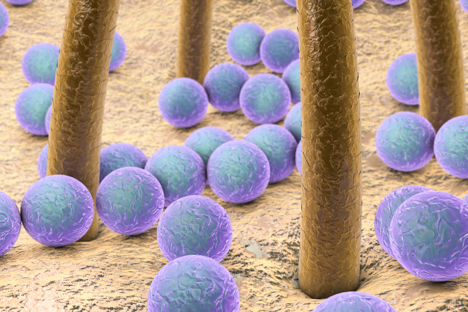 DermBiont Raises $8M Series A to Treat the Root Cause of Skin Diseases ...