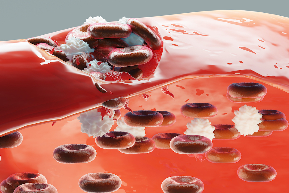 Aurealis therapeutics raises $10 million in an oversubscribed series A ...