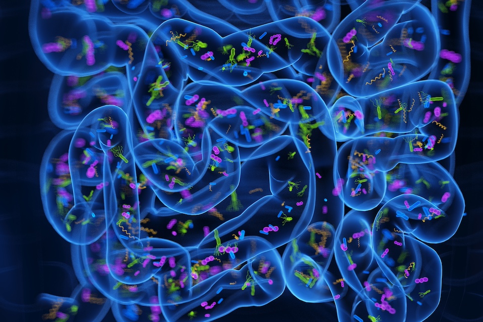 A New Path Toward Microbiome-Informed Precision Nutrition - Microbiome ...