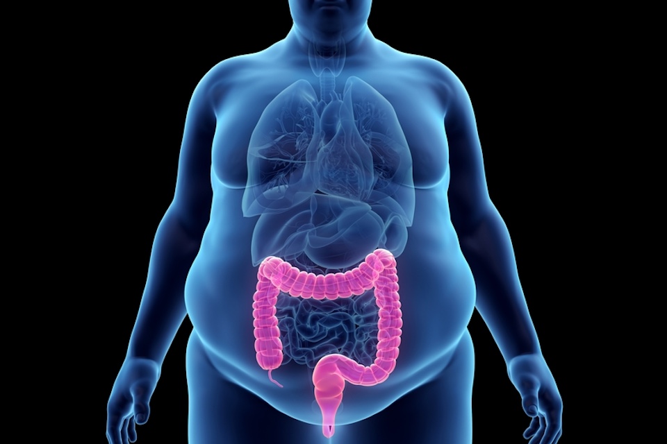 Bloom Science Demonstrates Durable Weight Loss in Overweight ...